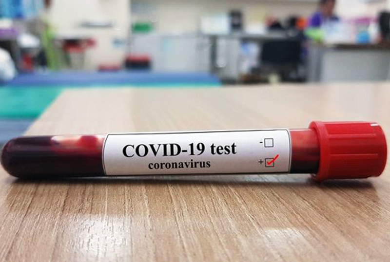 Previous post Kasus Positif Covid-19 di KSB Terus Bertambah